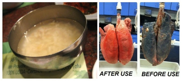 This Recipe Will Easily Clear Your Lungs In 3 Days, Even If You Smoke ...