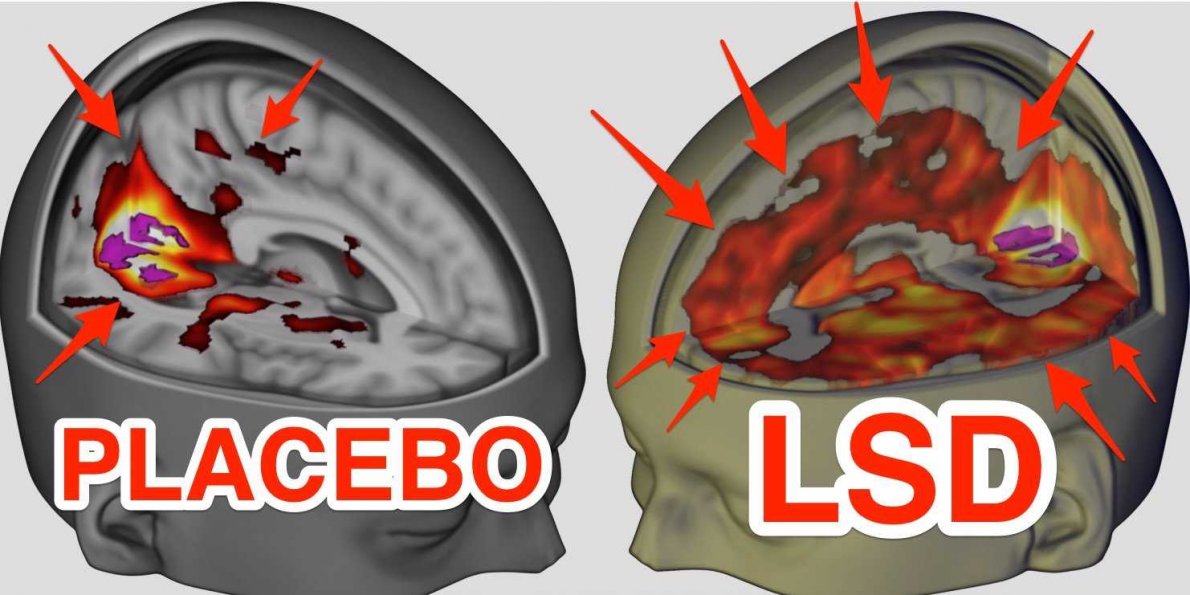 Scientists Took Images Of The Brains Of People On LSD. The Results BLEW ...