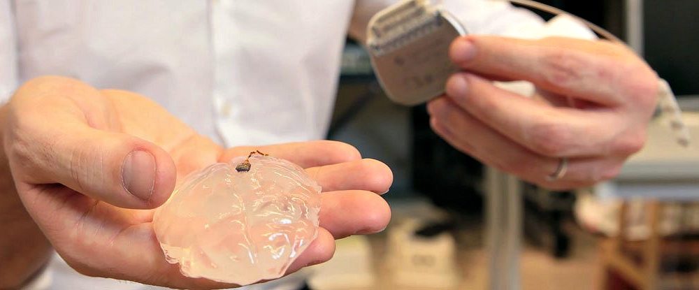 Scientists Shocking Invention - A Wireless Brain Implant Enables ...