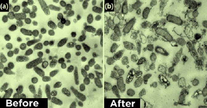 WATCH: Cannabis Causes Cancer Cells To Commit Suicide By Eating Itself