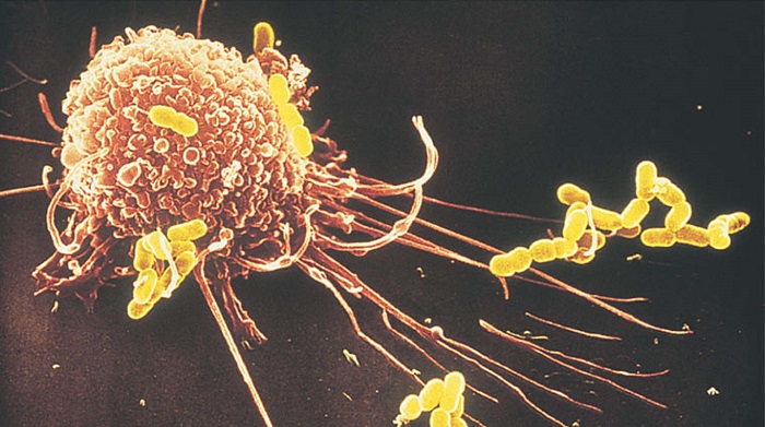 Scientists Have Discovered A Way To Destroy Cancer Tumors Using Nothing ...