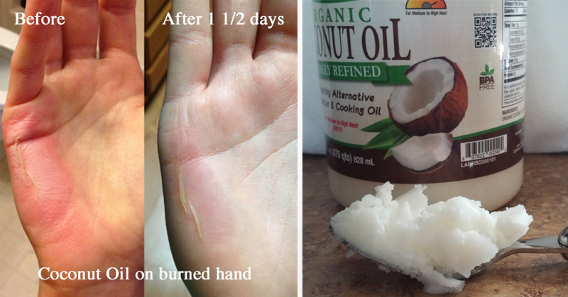 13 Studies Prove Why You Must Use Coconut Oil On A Daily Basis