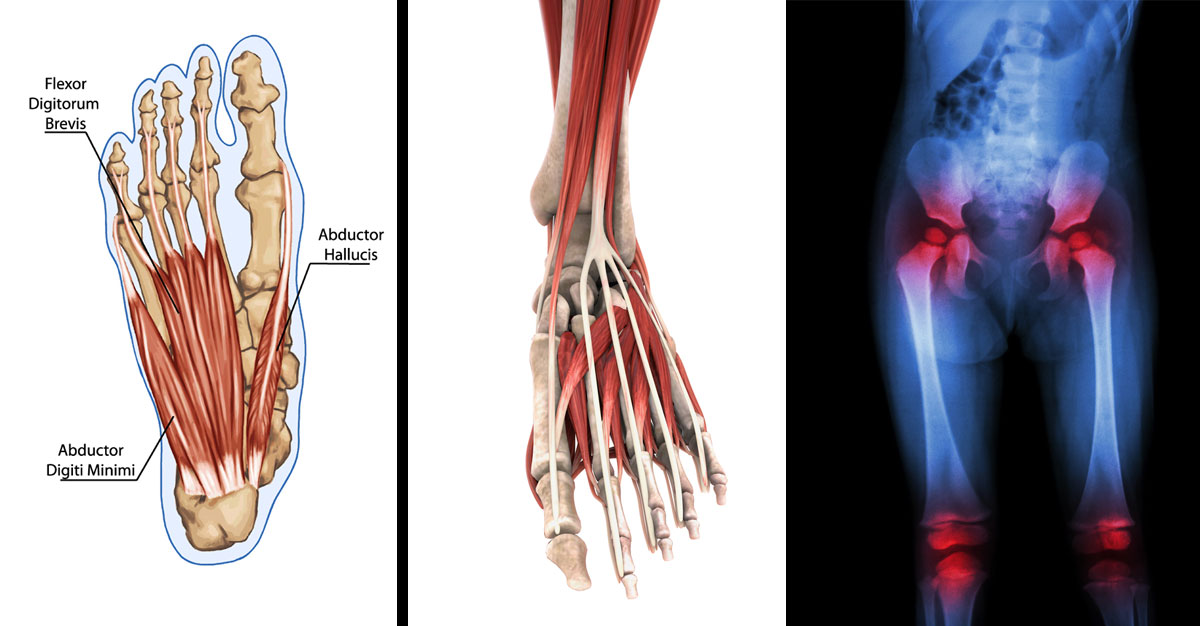 4 Foot Exercises That Will Get Rid of Lower Back, Knee and Hip Pain In ... 4 Foot Exercises That Will Get Rid of Lower Back, Knee and Hip Pain In ...