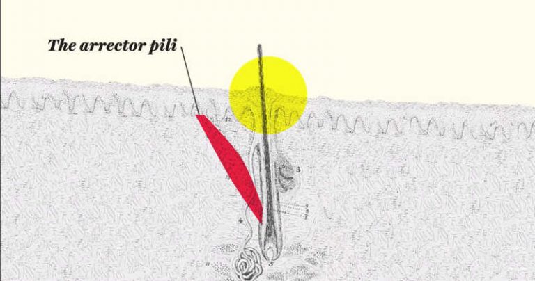 If Your Tendon Pops Out On Your Wrist Like This, This Is What It Means ...